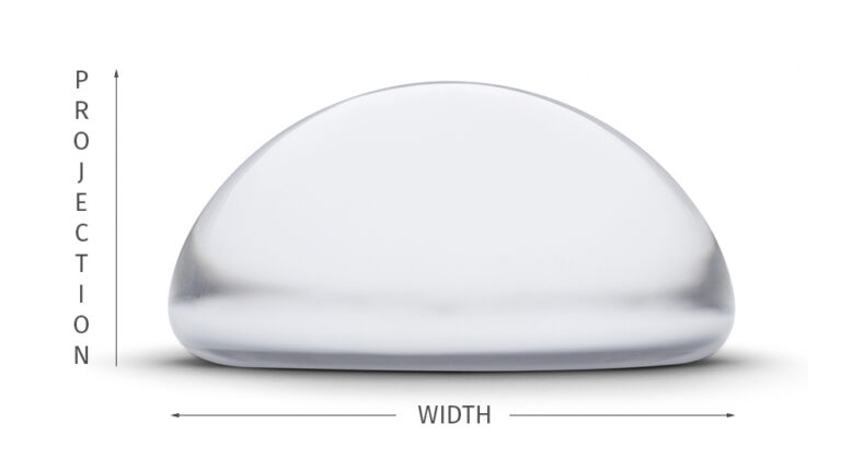 What does a breast implant "profile" mean? - AI Plastic Surgery