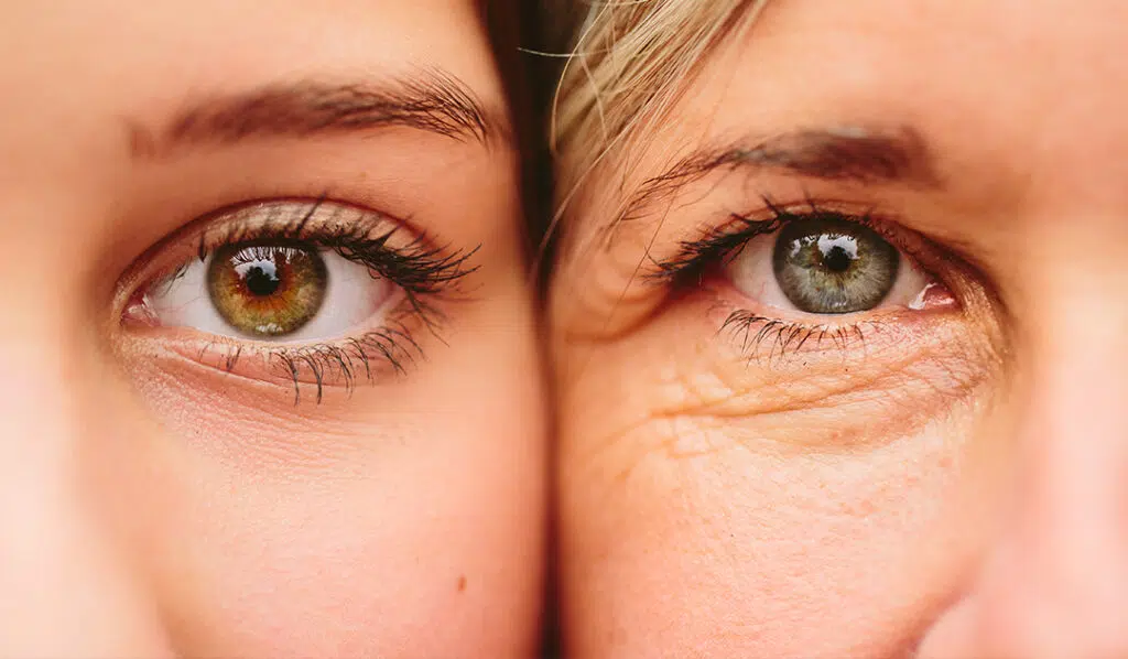 What Happens to Our Face as We Age? - AI Plastic Surgery